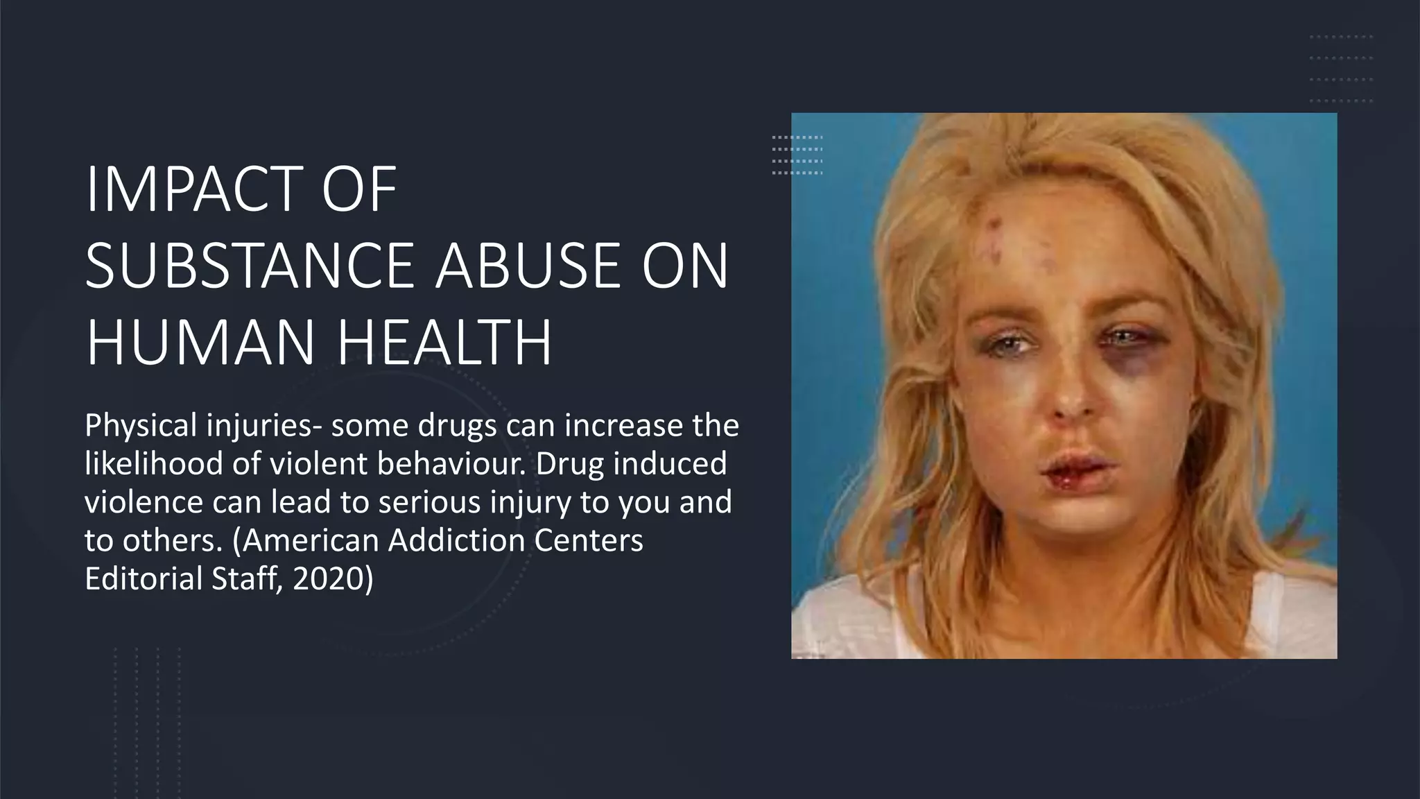 Substance use and abuse | PPTX