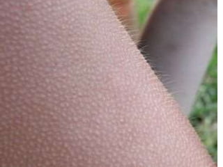 Substance abuse UNIT IV.pptx