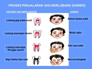 Kesehatan gigi dan mulut pada anak - anak | PPT