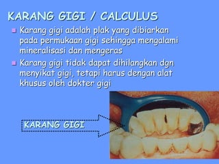 Kesehatan gigi dan mulut pada anak - anak | PPT