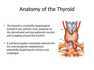 Substernal_Goiter surgery _Presentation.pptx