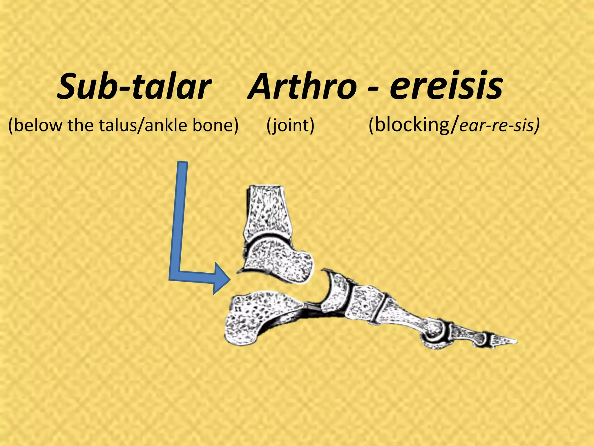 Subtalar Arthroereisis Explained | PPTX
