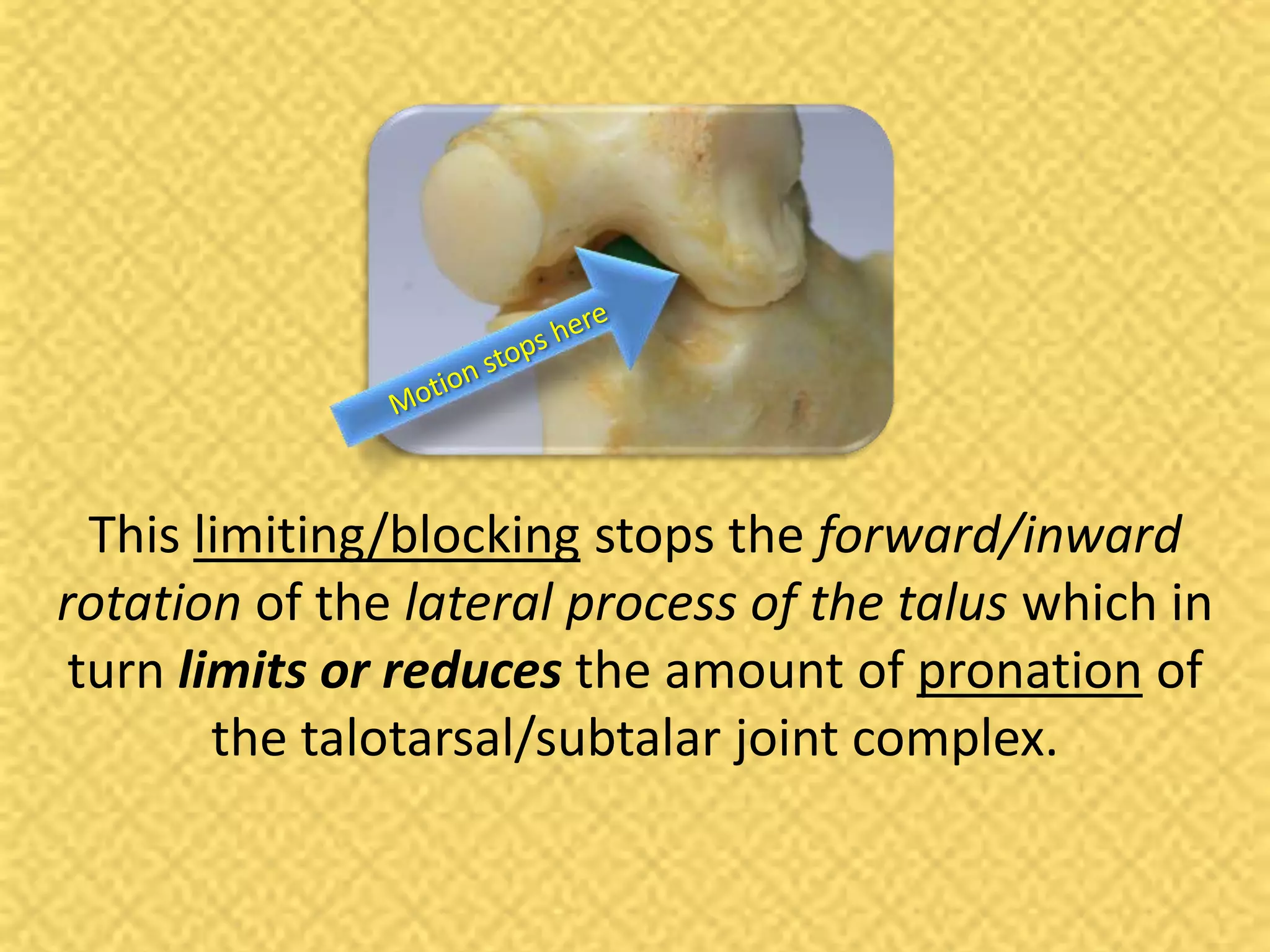 Subtalar Arthroereisis Explained | PPTX