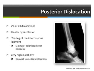 Subtalar Dislocations | PPTX