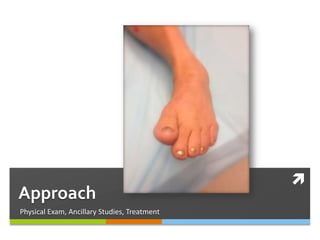 Subtalar Dislocations | PPTX