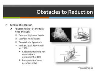 Subtalar Dislocations | PPTX