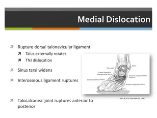 Subtalar Dislocations | PPTX