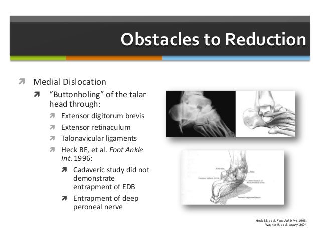 Subtalar Dislocations