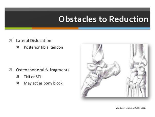 Subtalar Dislocations