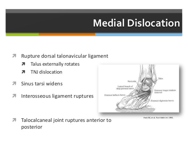 Subtalar Dislocations