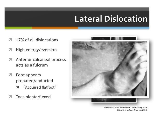 Subtalar Dislocations