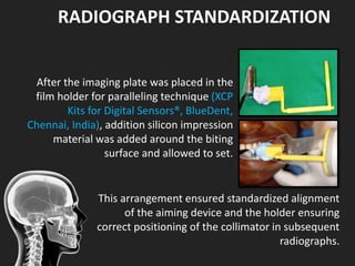Subtraction radiography and morphometric analysis in periodontics | PPTX