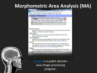 Subtraction radiography and morphometric analysis in periodontics | PPTX