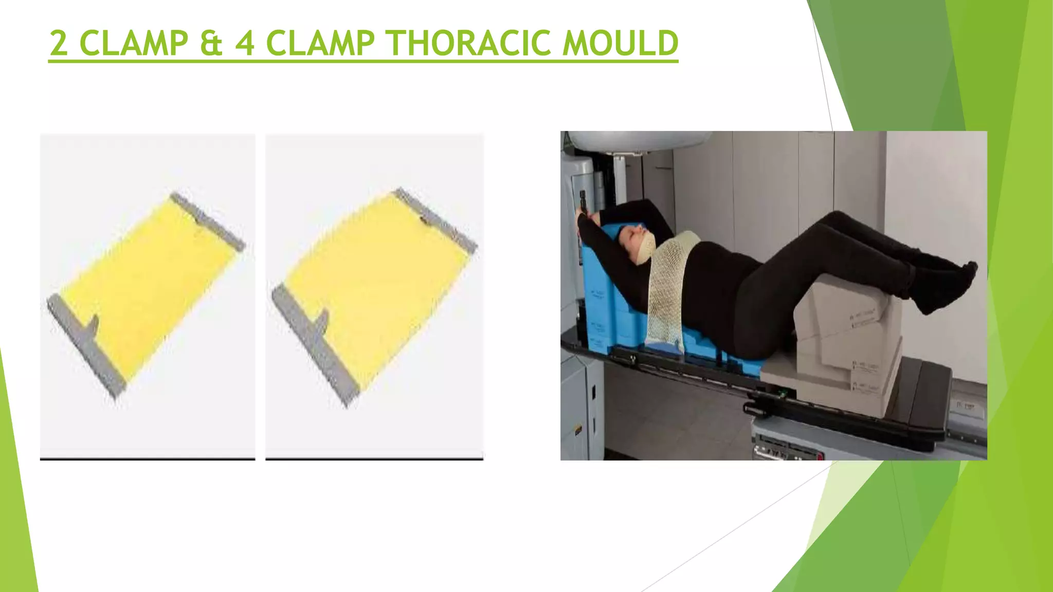 IMMOBILIZATION IN RADIOTHERAPY | PPTX
