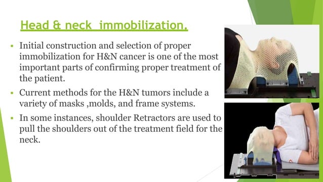 IMMOBILIZATION IN RADIOTHERAPY | PPTX