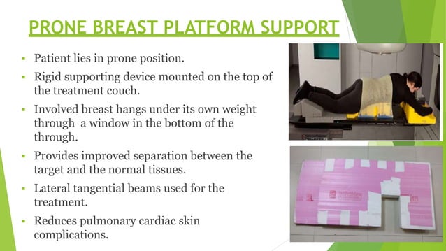 IMMOBILIZATION IN RADIOTHERAPY | PPTX