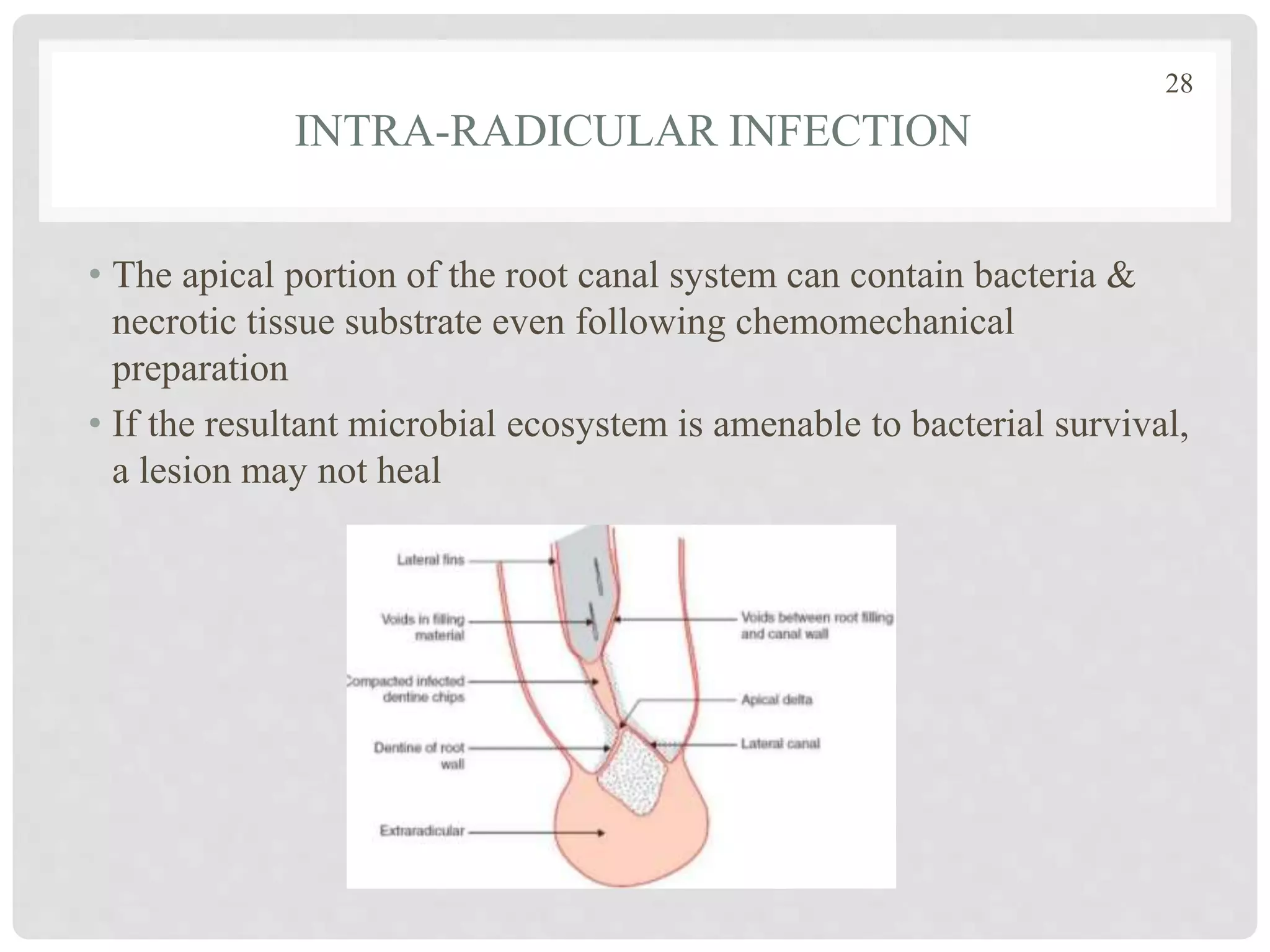 Success and failures in Endodontics | PPTX