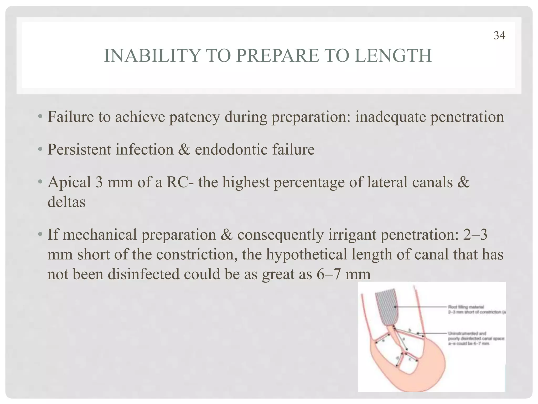 Success and failures in Endodontics | PPTX
