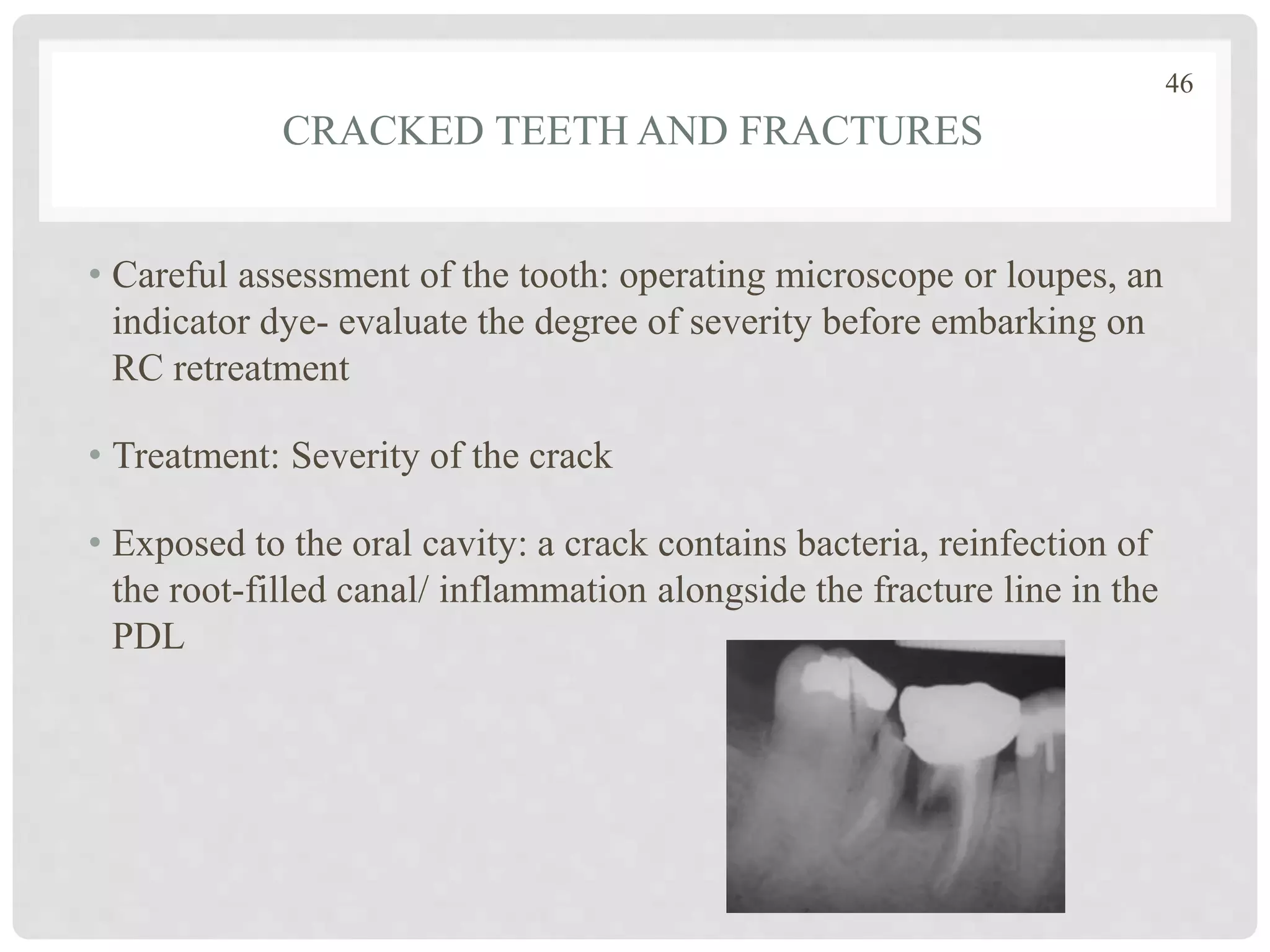 Success and failures in Endodontics | PPTX