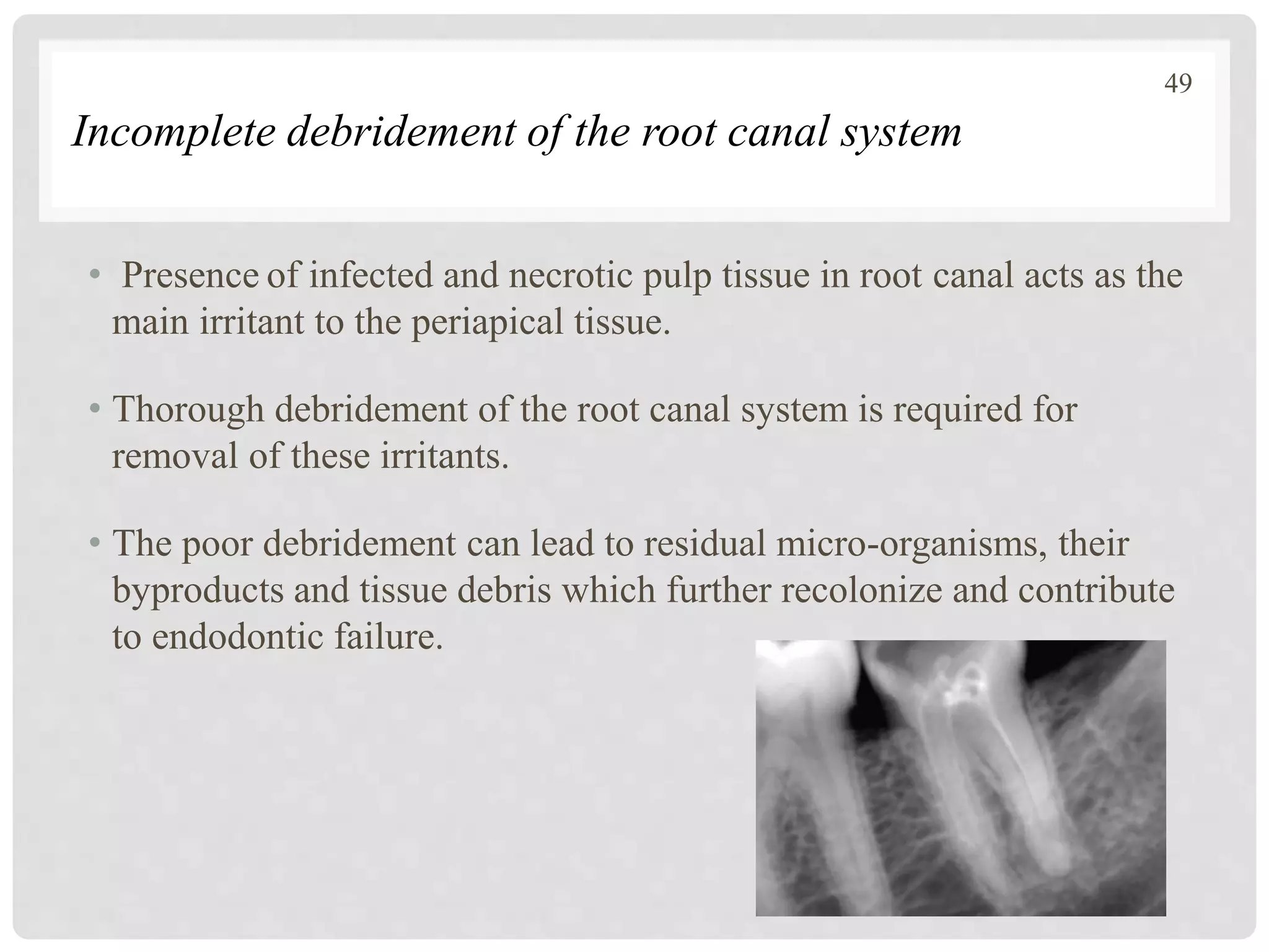 Success and failures in Endodontics | PPTX