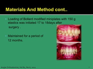 Success rate of miniplate anchorage for bone anchored maxillary protraction | PPTX