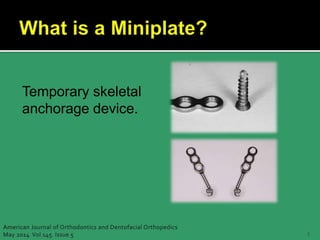 Success rate of miniplate anchorage for bone anchored maxillary protraction | PPTX