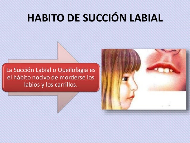 Hábito de Succión Labial