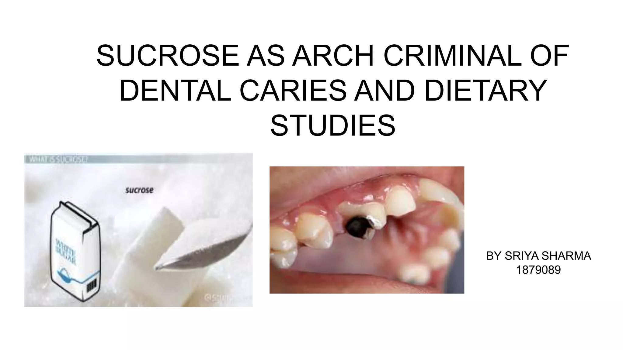 Sucrose as arch criminal of dental caries and dietary studies | PPTX