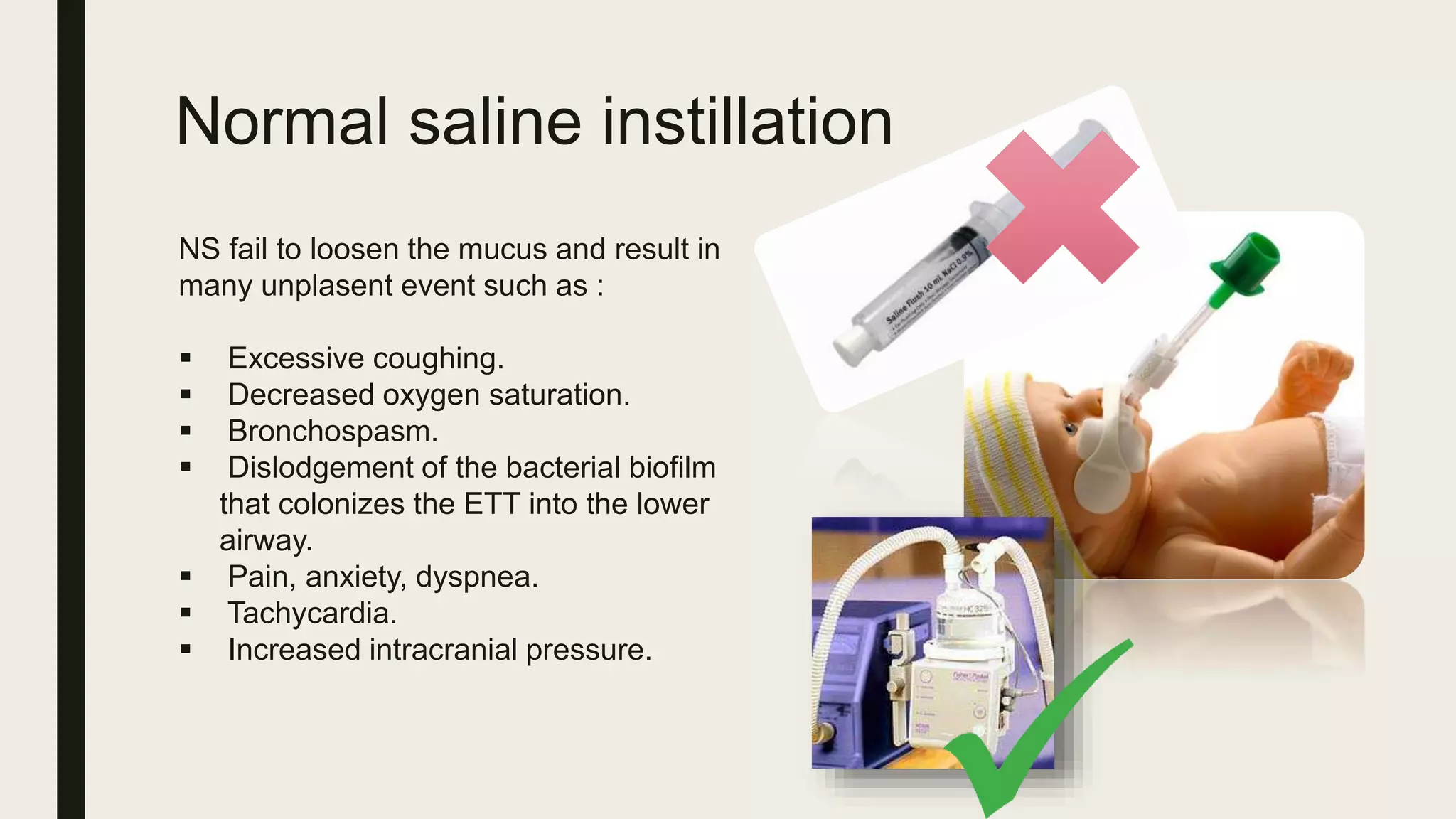 Suctioning -neonates- | PPTX