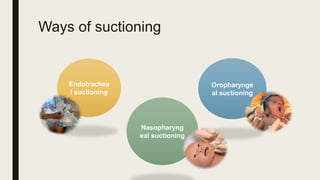 Suctioning -neonates- | PPTX