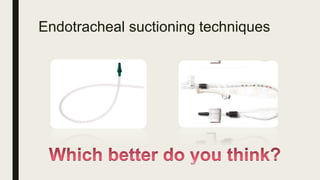 Suctioning -neonates- | PPTX