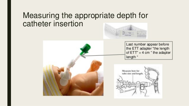 Endotracheal Suctioning In Neonates Intubation | Safer Care Victoria