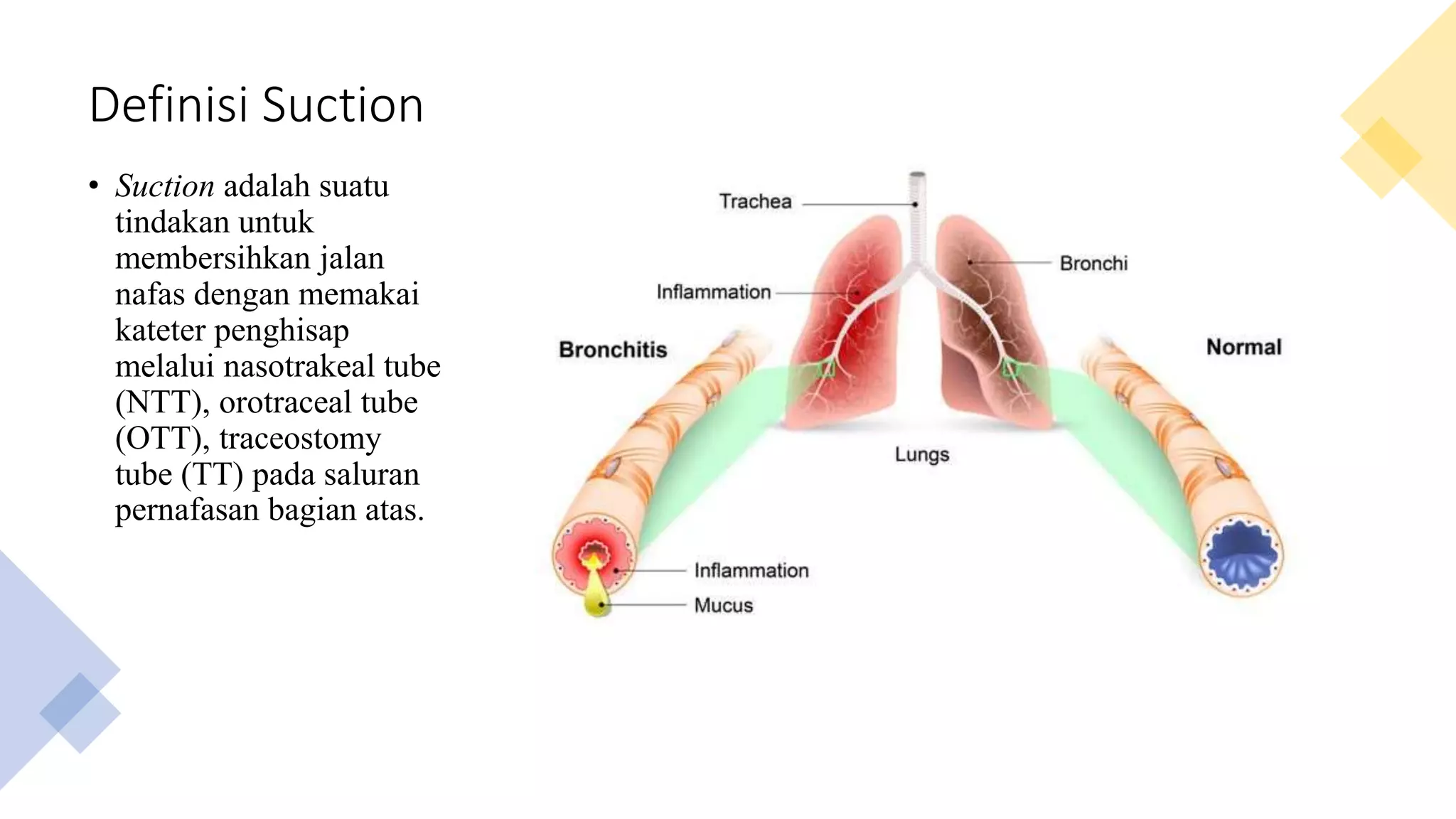 Tindakan Suctioning.pptx