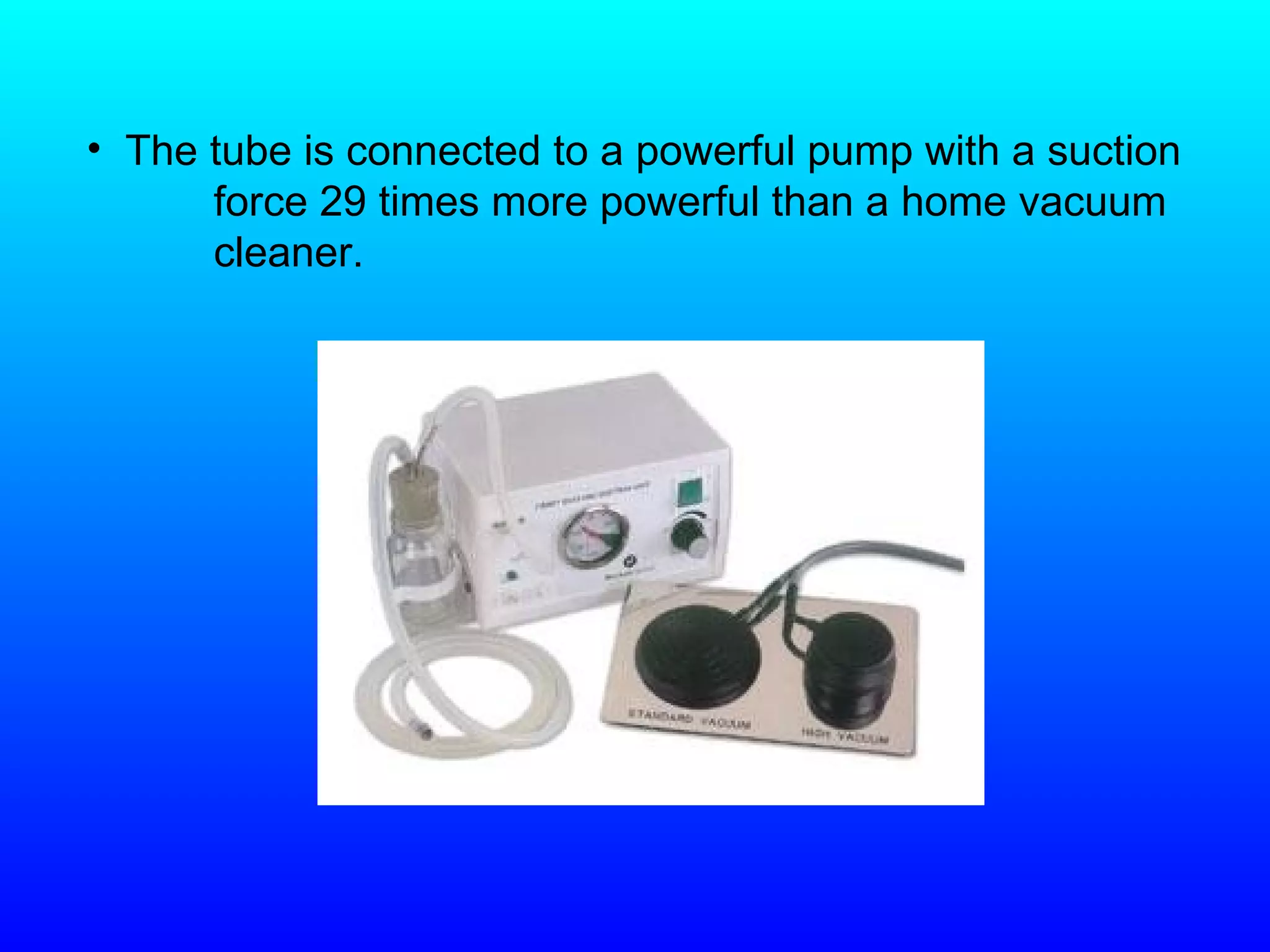 Abortion-Suction | PPT