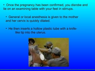 Abortion-Suction | PPT