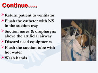 Endo tracheal Suctioning | PPT