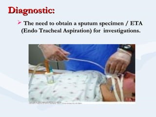 Endo tracheal Suctioning | PPT