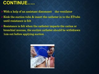 Suction therapy for ICU Patients | PPT