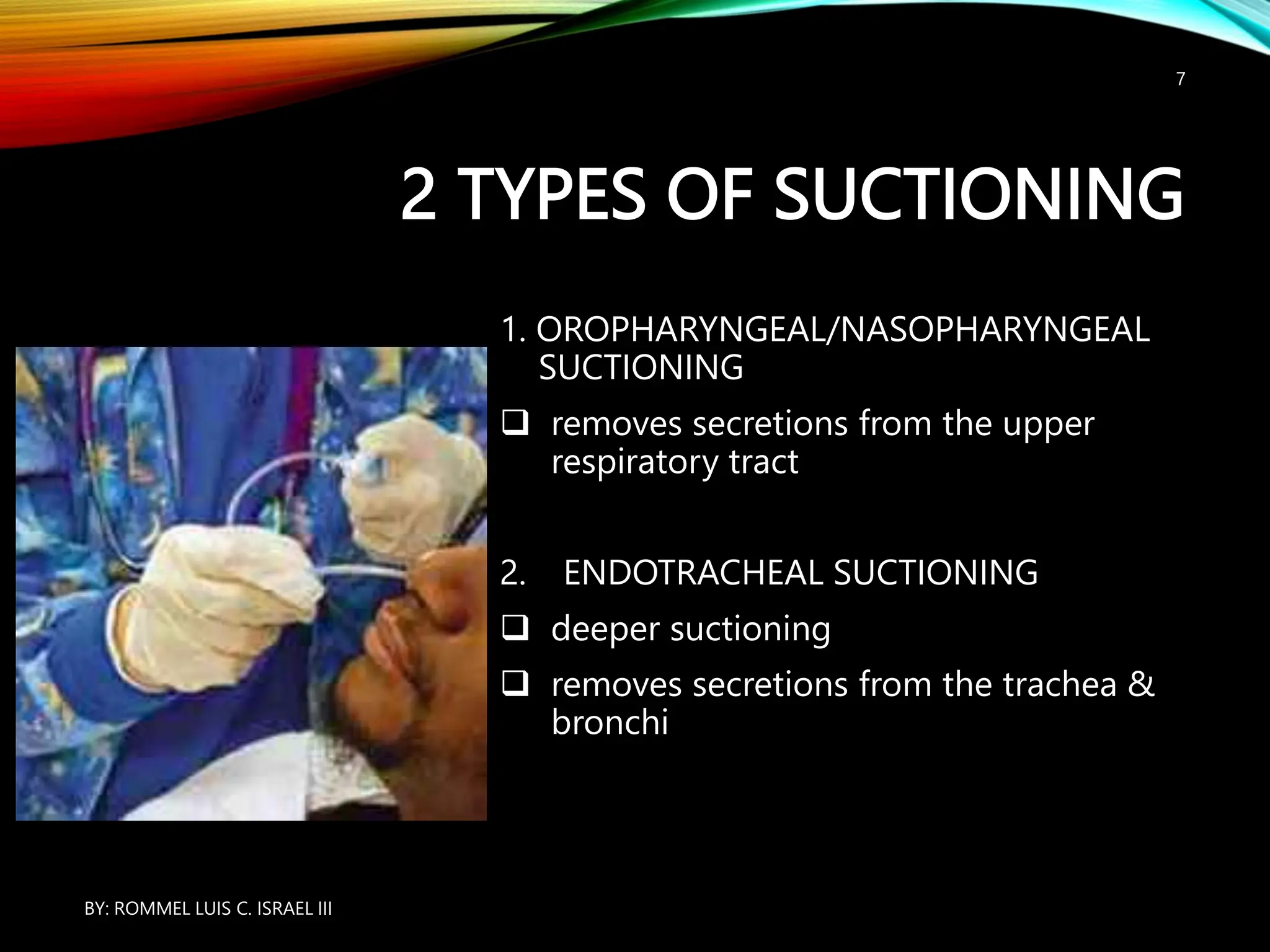 SUCTIONING OROPHARYNGEAL AND NASOPHARYNGEAL CAVITIES | PPTX