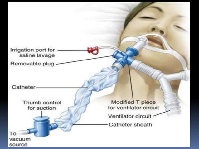 suctioning-procedure-ppt full.pptx