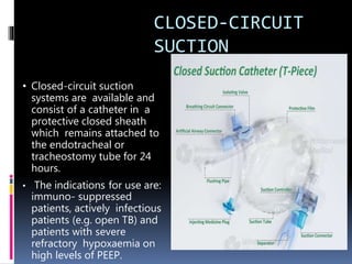 Tracheostomy Suctioning Closed System