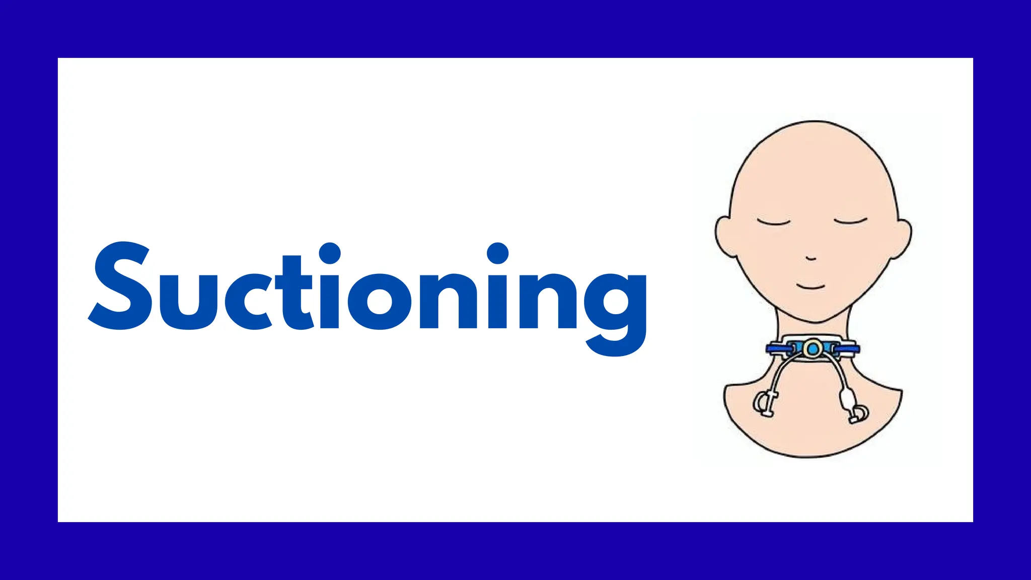 Suctioning in Nursing: Types, Procedure and Complications Overview.pdf