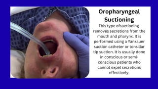 Suctioning in Nursing: Types, Procedure and Complications Overview.pdf