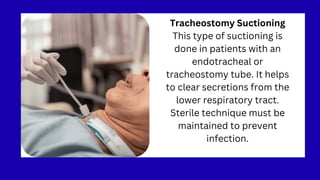 Suctioning in Nursing: Types, Procedure and Complications Overview.pdf