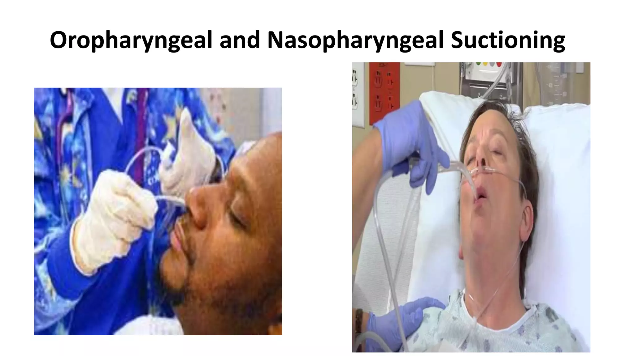 Suctioning checklist deveelopment | PPTX