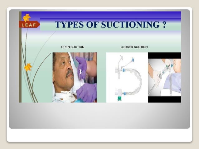 suctioning procedure ppt.pptx