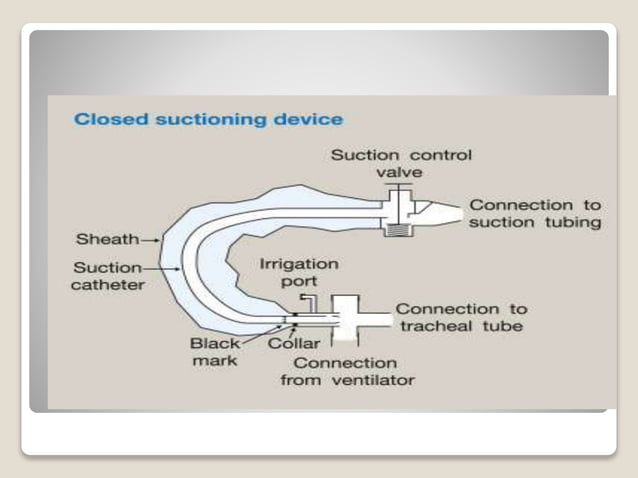 suctioning procedure ppt.pptx | Lung and Respiratory Health | Diseases ...