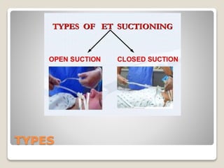 suctioning procedure ppt.pptx