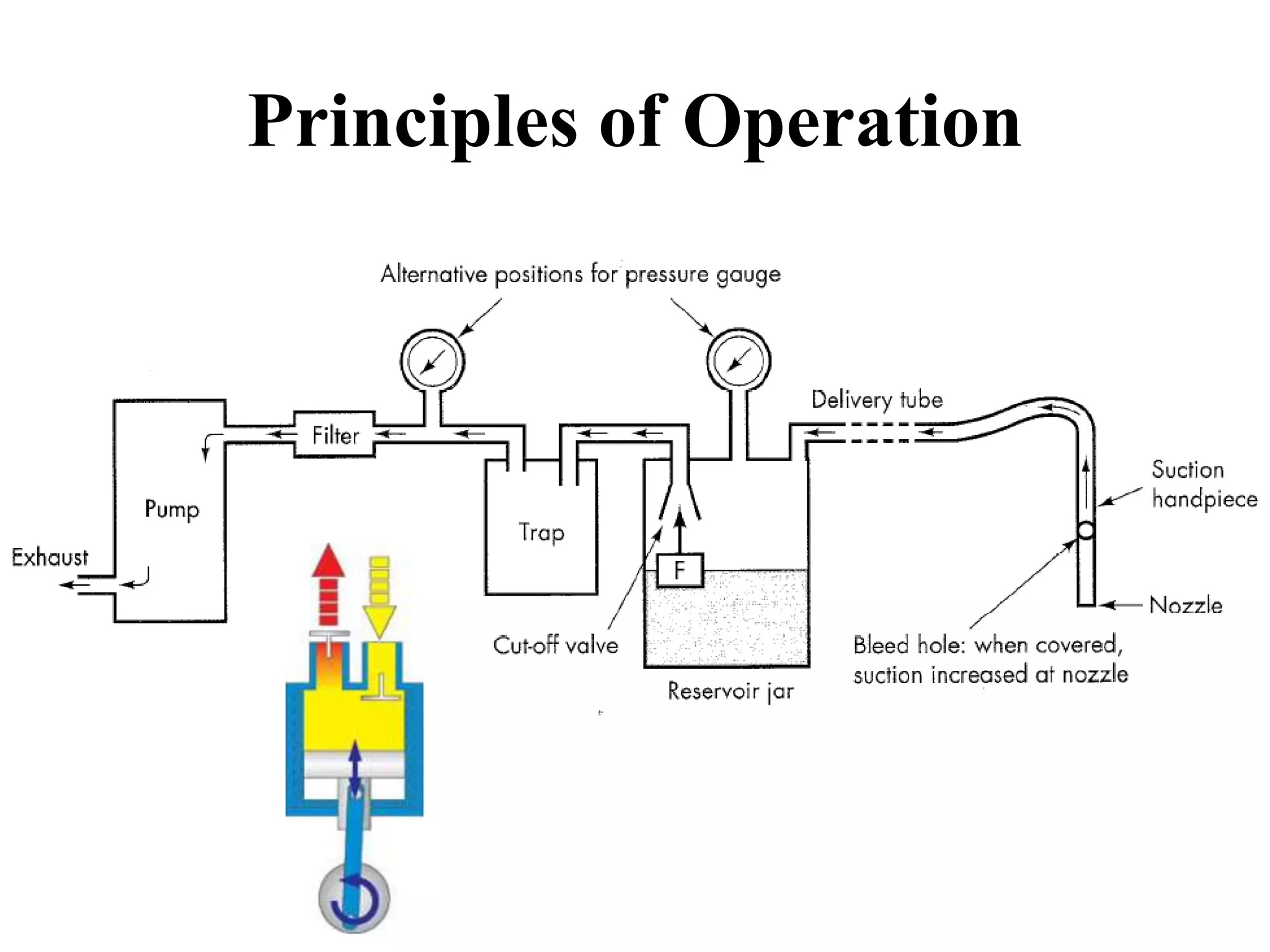 Suction machine.. | PPTX