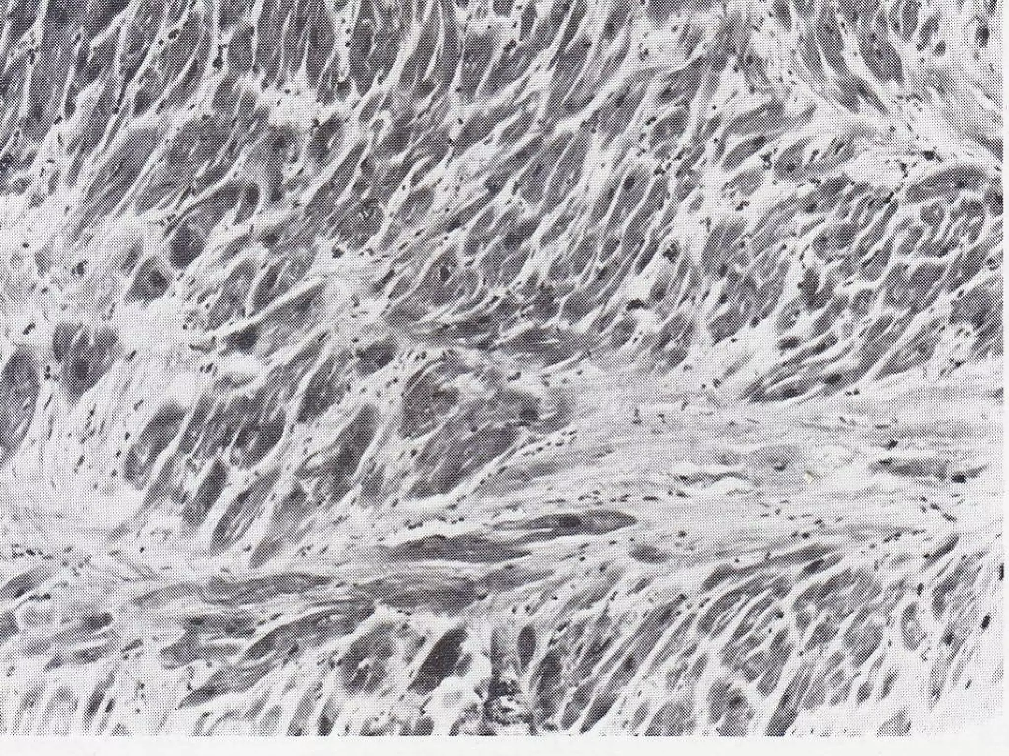 Sudden cardiac death | PPT | Heart and Cardiovascular Diseases ...